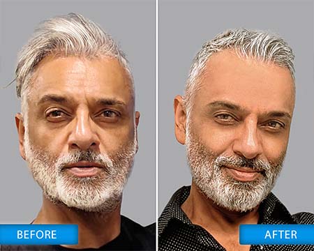 Anti-Aging Cream Designed For Men I Particle
