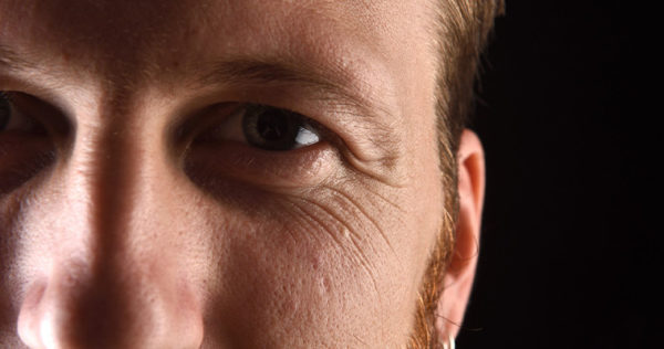 How To Get Rid Of Crows Feet: Prevention And Actionable Tips