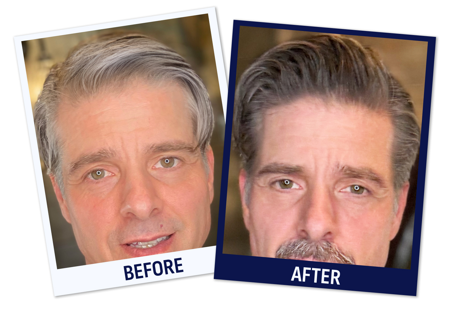 How to Use Anti-Gray Serum | Complete Particle Guide